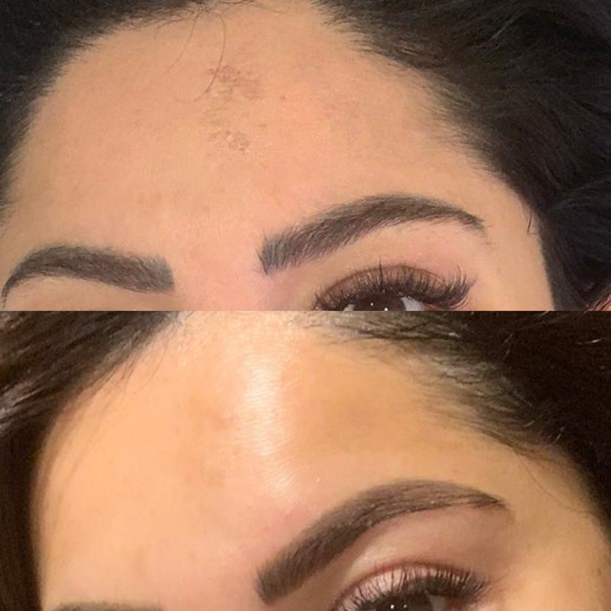 Kemijski pilling – Venus